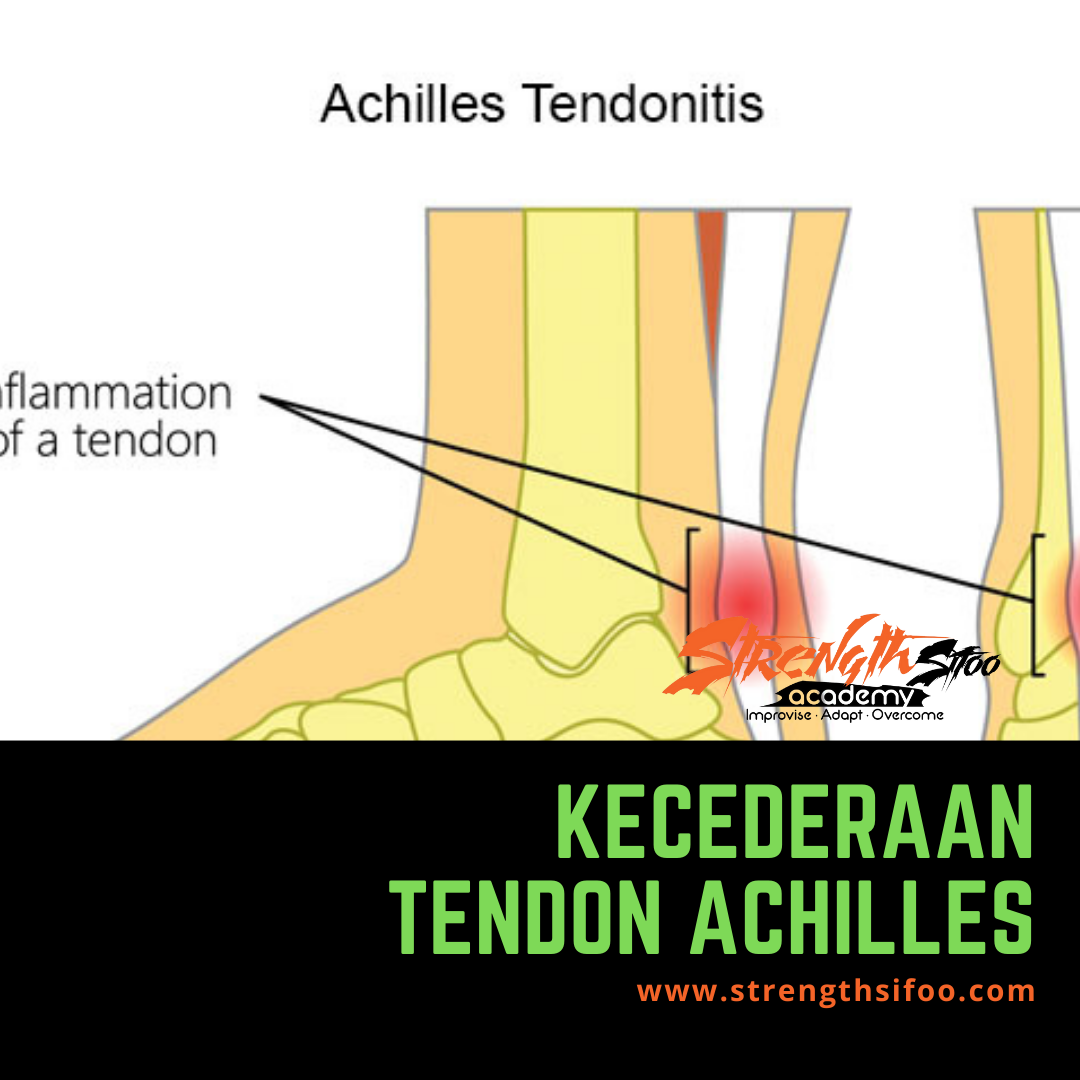 Kecederaan Tendon Achilles