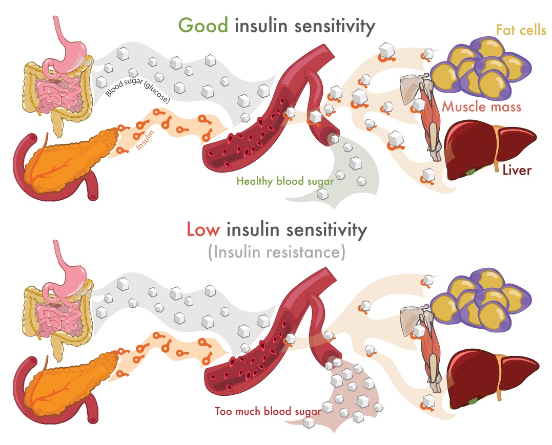 Senaman- Rahsia Memperbaiki Keseimbangan Hormon